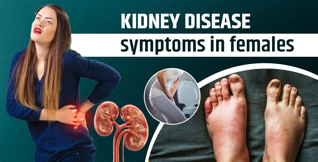 Early Kidney Disease Symptoms in Women: Must-Know Signs