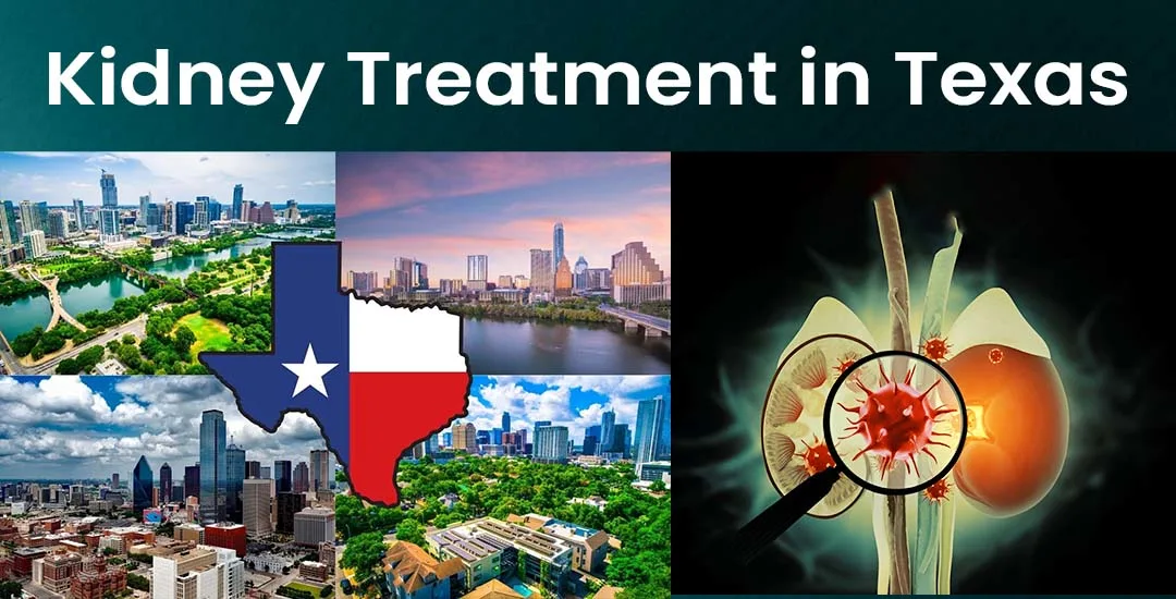 Best Kidney Treatment Centers in Texas