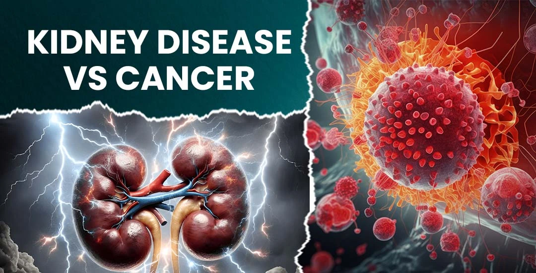 Kidney Disease vs. Cancer: Spot the Symptoms & Know the Warning Signs