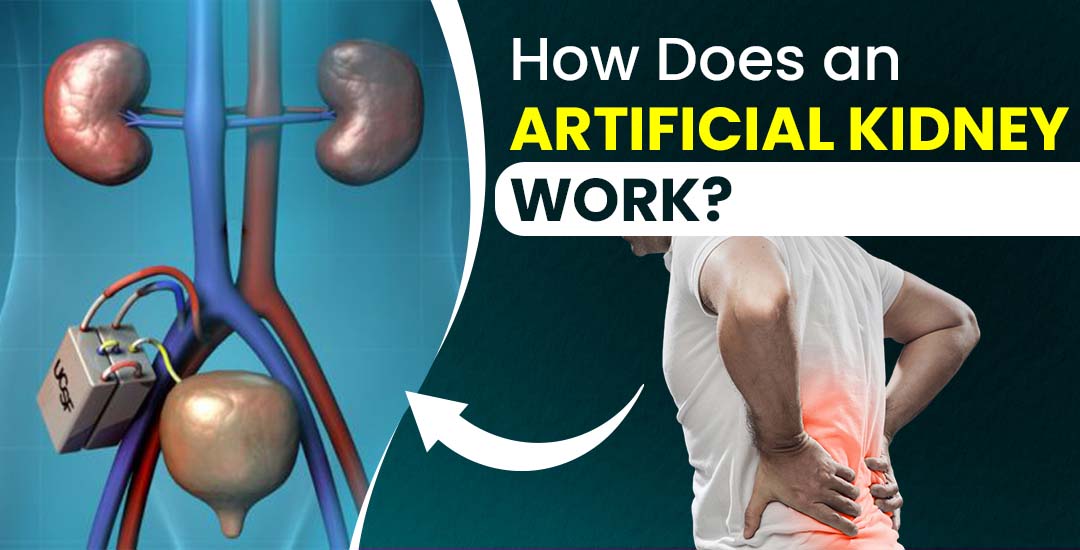 Artificial Kidney Explained — How It Works & Helps Patients
